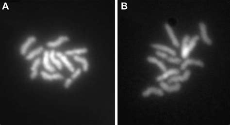—examples Of Dapi Stained Mitotic Metaphase Spreads Of Early H