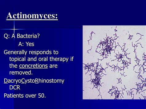 Ppt Posterior Blepharitis Powerpoint Presentation Free Download Id