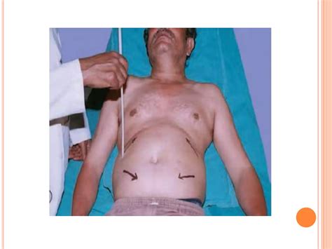 Reflexes Superficial And Deep Tendon Reflexes Pptx