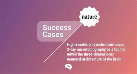 High Resolution Synchrotron Based X Ray Microtomography As A Tool To