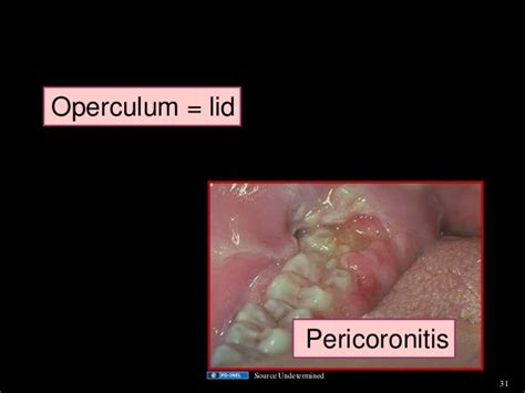 Gemc Dental Emergencies And Common Dental Blocks Resident Training