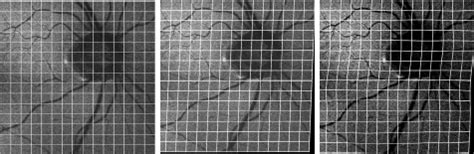 A Control Grid Before Registration B Control Grid After The Affine Download Scientific