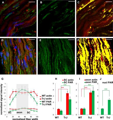 f actin increase intr j mice sciatic nerves was paralleled by par