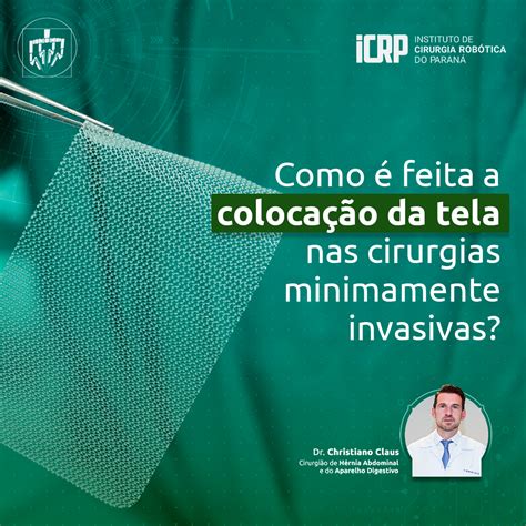 COMO É FEITO A COLOCAÇÃO DA TELA NAS CIRURGIAS MINIMAMENTE INVASIVAS Instituto de Cirurgia