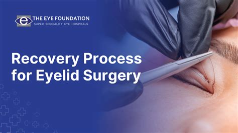 What Is The Recovery Process For Reconstructive Eyelid Surgery