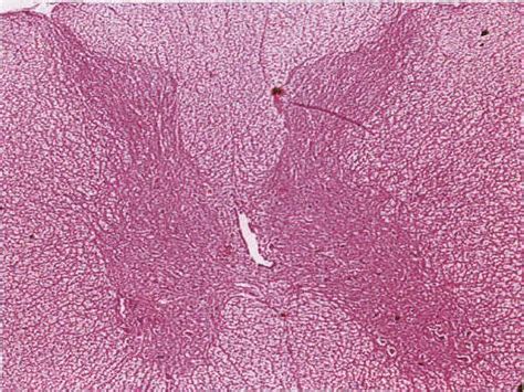 图14 7 脊髓 病理组织 图片