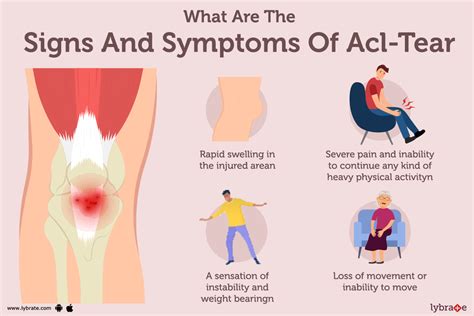 Anterior Cruciate Ligament Acl Tear Symptoms Causes Treatment And