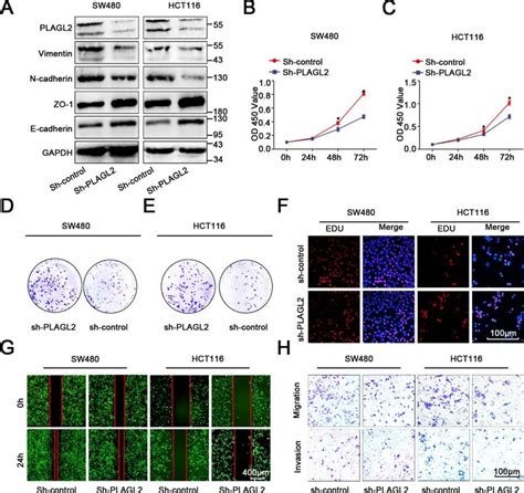 Plagl2 Accelerates Crc Cell Growth And Migration A Wb Indicated That