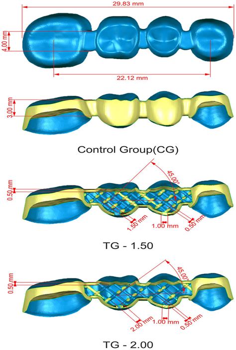 Metal Ceramic Framework Design Download Scientific Diagram