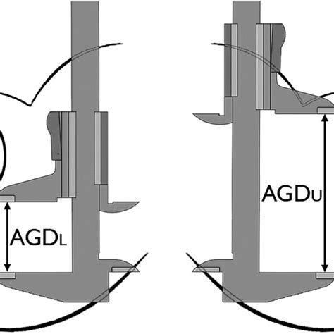 External Genitalia Score Describes Phenotypic Features At 5 Anatomical