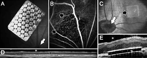 Figure 2 From Integration Of Perforated Subretinal Prostheses With Retinal Tissue Semantic