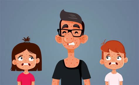 40 Illustrationer Royaltyfri Vektorgrafik Och Clip Art Med Rubella