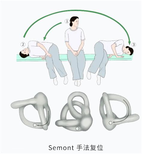 天旋地转别慌张！带你轻松了解耳石症。 校医院