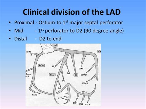 Anatomy Of The Coronary Circulation Angiographic VISUALIZATION Ppt