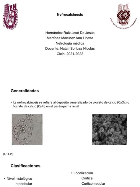Presentación Nefrocalcinosis Pdf Urología Riñón