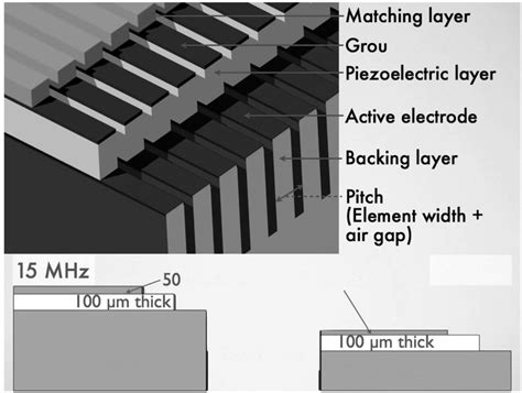 What Is A Linear Array Transducer At Lori Francois Blog