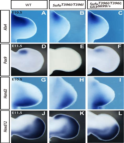 Gli3∆699 Suppresses The A P Polarity Defects In The Sufut396it396i