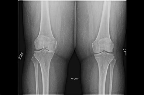 Ortho Dx Bilateral Knee Pain Clinical Advisor