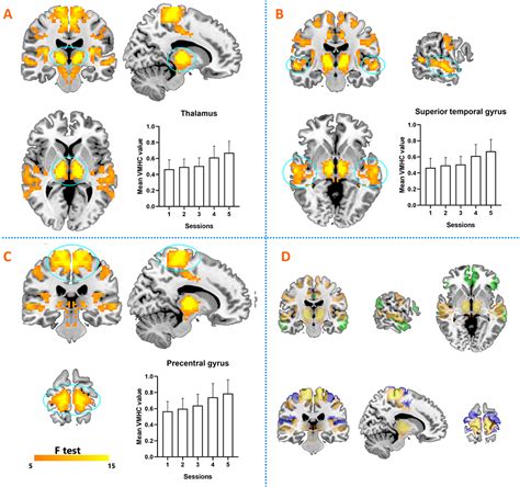 Gradually Increased Interhemispheric Functional Connectivity During On