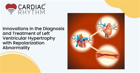 Innovations In The Diagnosis And Treatment Of Left Ventricular