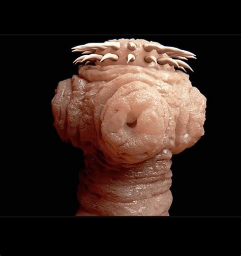 Tape Worm Under A Microscope R Dontputyourdickinthat