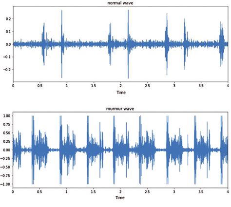Time Domain Pcg Trace And Its Power Spectral Density For Normal And