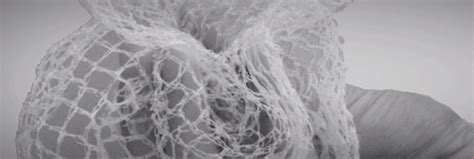 Transvaginal Mesh Part 2 Deadly Devices