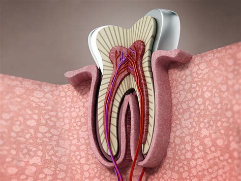 Root Canal Riverside Ca Root Canal Therapy