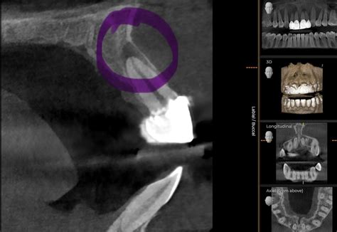 Cbct Scans London Optimal Dental Health