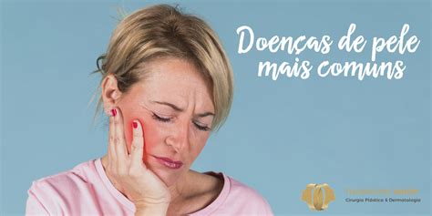 Doenças De Pele Mais Comuns Thompson Sinop Cirurgia Plástica E