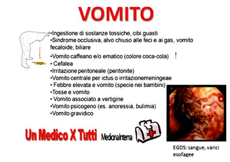 Vomito Fecale Umano Tumore Colon Sintomi Iniziali E Avanzati