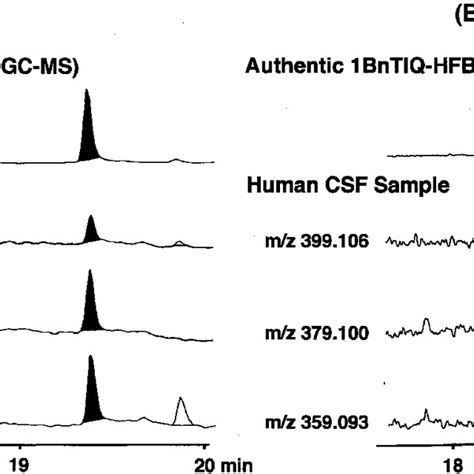 GC SIM Chromatogram Of The Mouse Brain And The Human Cerebrospinal Download Scientific Diagram