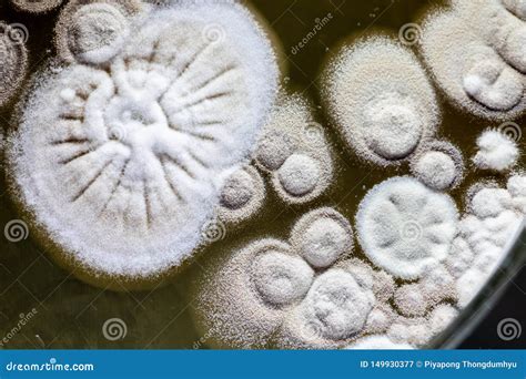 Study Colony Characteristic Of Actinomyces Bacteria Yeast And Mold On