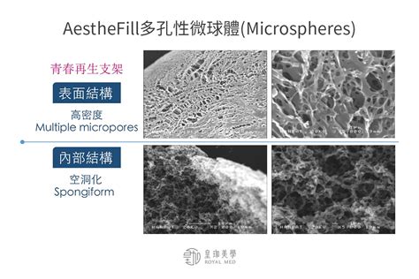 艾麗斯精靈針是什麼 聚雙旋乳酸原理 效果 副作用 價格費用 全解析