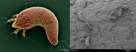 Left Phyllocoptes Fructiphilus As Seen Under The Scanning Electron