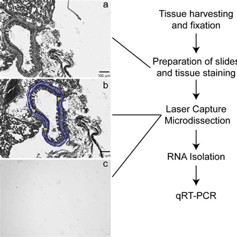 Workflow For The Laser Capture Microdissection LCM Of Lung Tissue