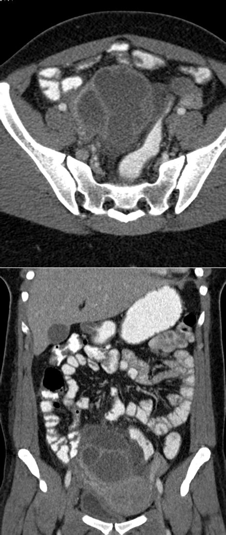 Cardiac Learning Modules Ct Scanning