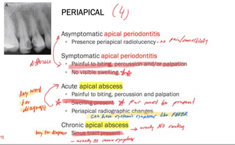 L6 Periapical Pathosis And Periapical Diagnosis Flashcards Quizlet
