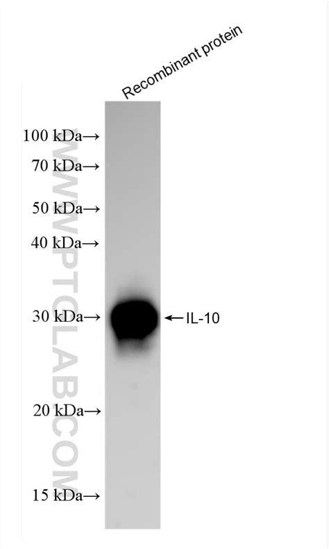 Il 10 Antibody 82793 16 Rr Proteintech