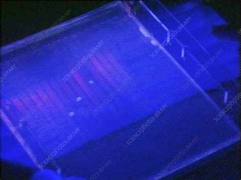 Scientist With Gel Electrophoresis Results Guys Hospital 1990