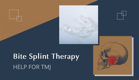 Bite Splint Therapy Tmj Treatments Mn Center For Dental Care