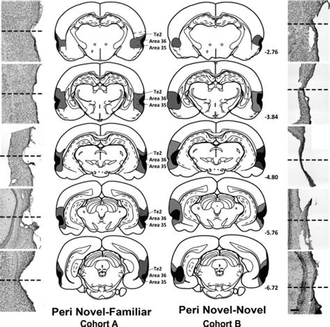 Diagrammatic Reconstructions Of The Perirhinal Cortex Lesions Peri Download Scientific