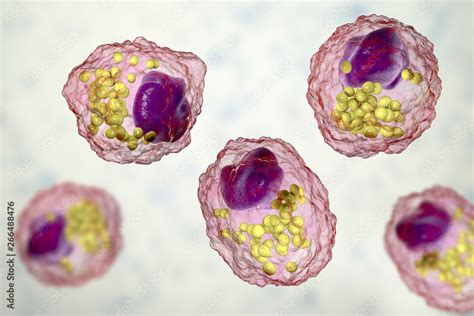 Foam Cell A Macrophage Cell With Lipid Droplets Stock Illustration