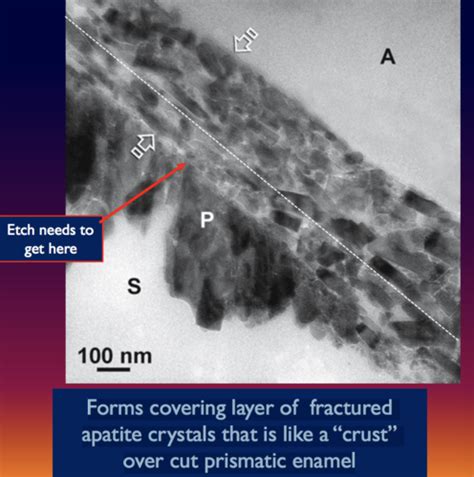 5 Concepts Of Enamel And Dentin Adhesion Flashcards Quizlet