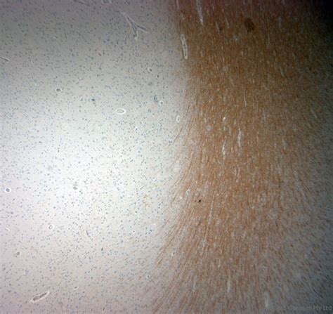 Anti Mbp Maltose Binding Protein Antibody Rabbit Anti Human Ihc Lsbio