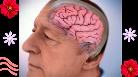 El Alzheimer Youtube