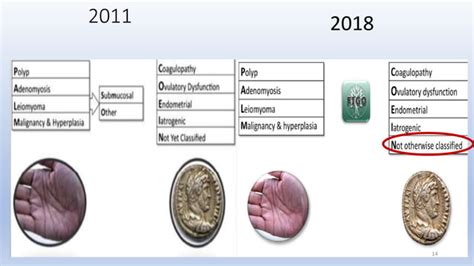 Palm Coein Classification Its Clinical Significance Final