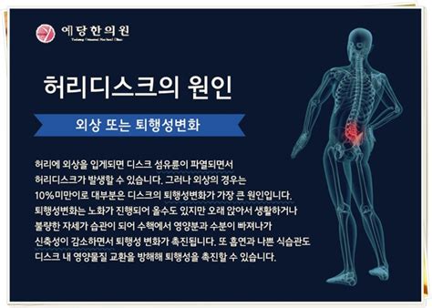 허리디스크초기증상 주의하세요 네이버 블로그