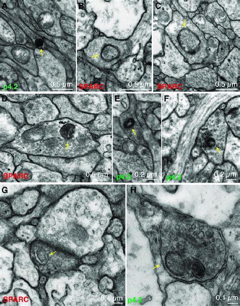 Presence Of Multiple Organelles Of The Endolysosomal System In Axon