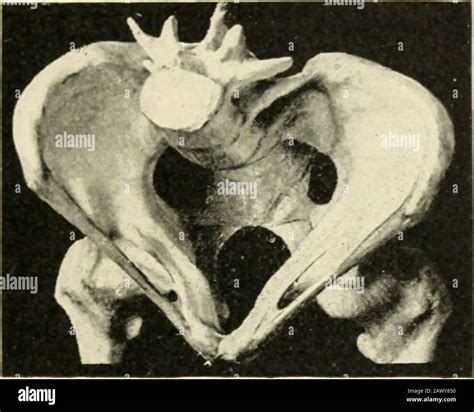 A Textbook Of Obstetrics Every Force Imposed Upon Them They Bend Before Thepressure Of The